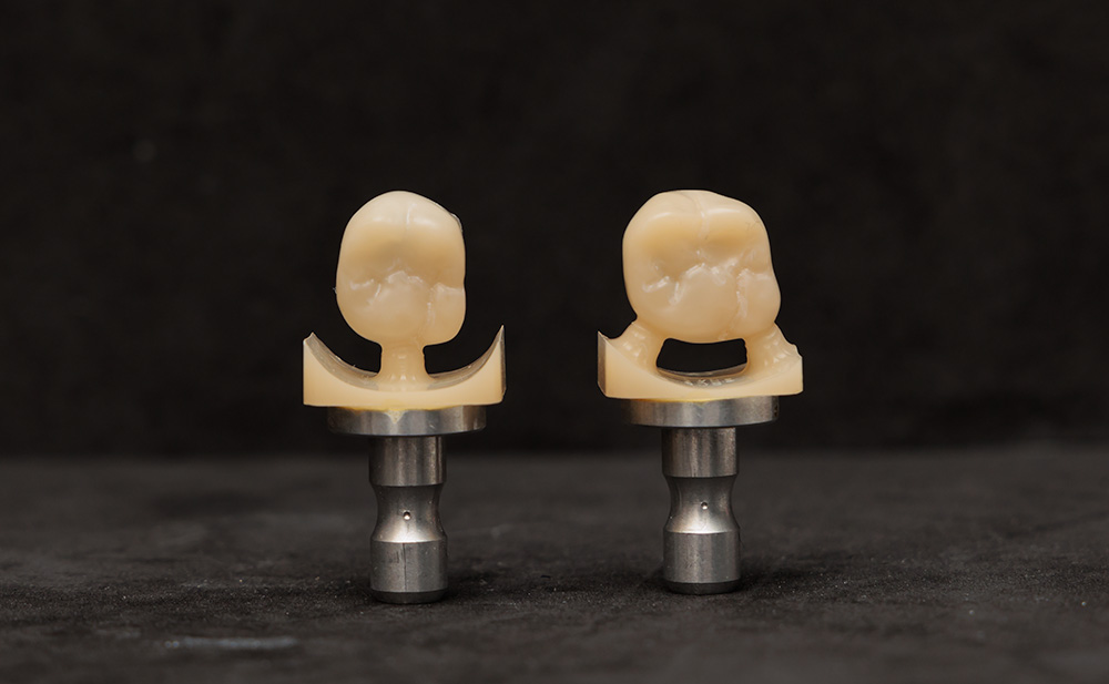 Shade Taking ｜ 静岡県富士市の歯科技工所 株式会社Brains